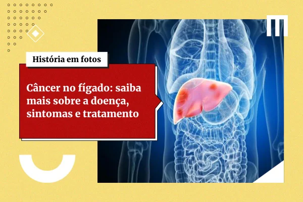 Câncer de fígado: conheça as principais causas e como se prevenir ...
